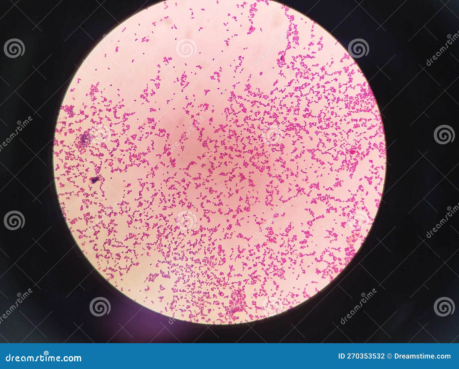 Gram Staining , is a Method of Differentiating Bacterial Species. Gram ...