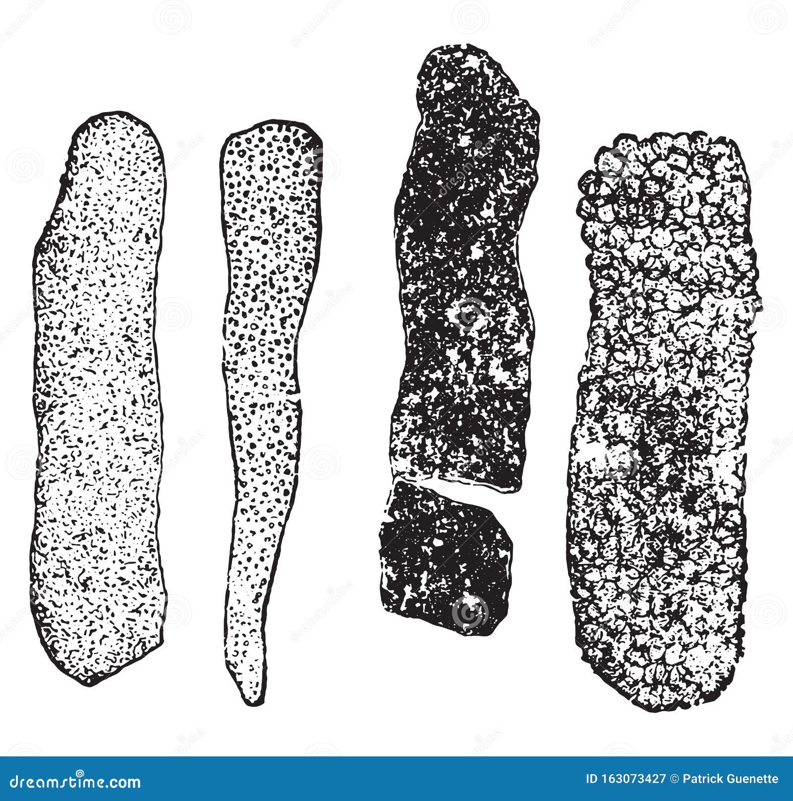 Granular Casts, Vintage Engraving Stock Vector - Illustration of human ...