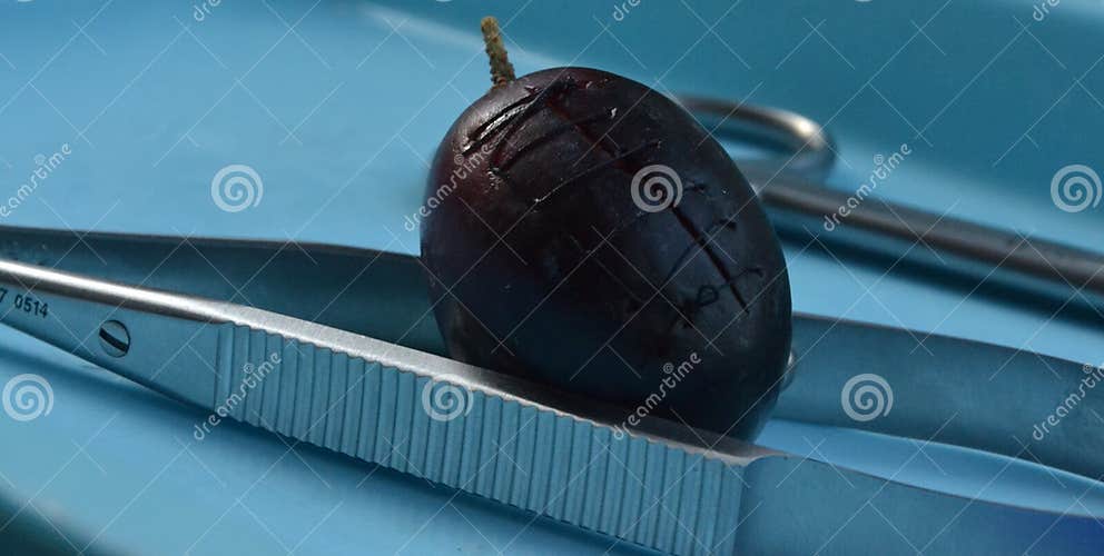 Grape stock photo. Image of medical, grape, surgery - 162003844
