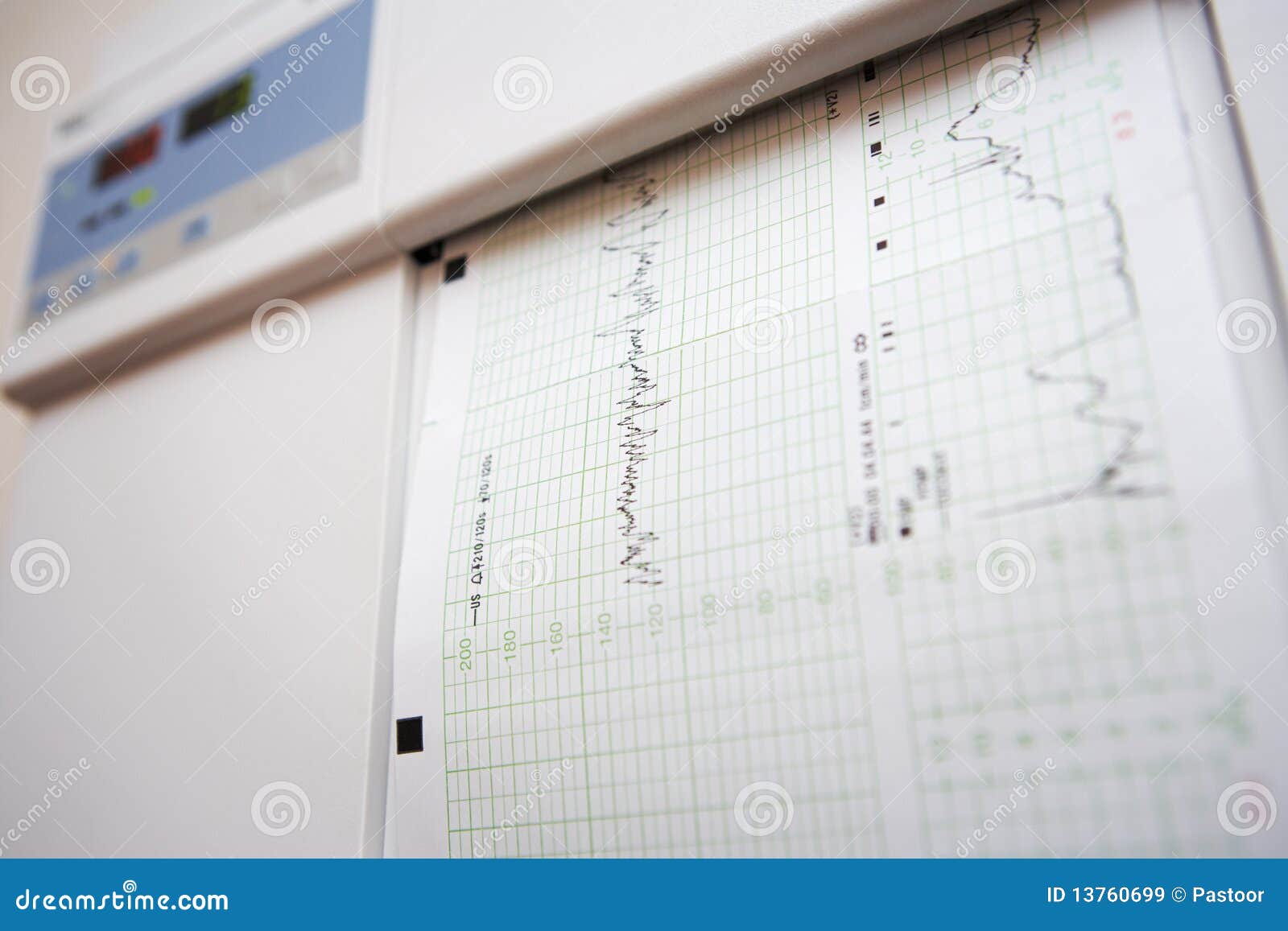Graph of contractions stock image. Image of color, examination - 13760699