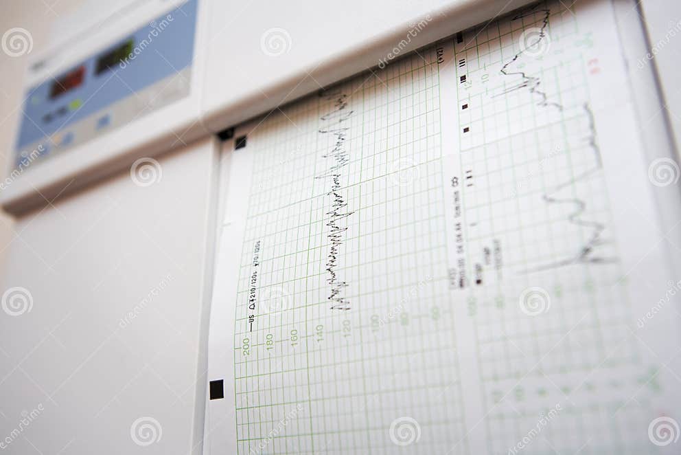 Graph of contractions stock image. Image of color, examination - 13760699