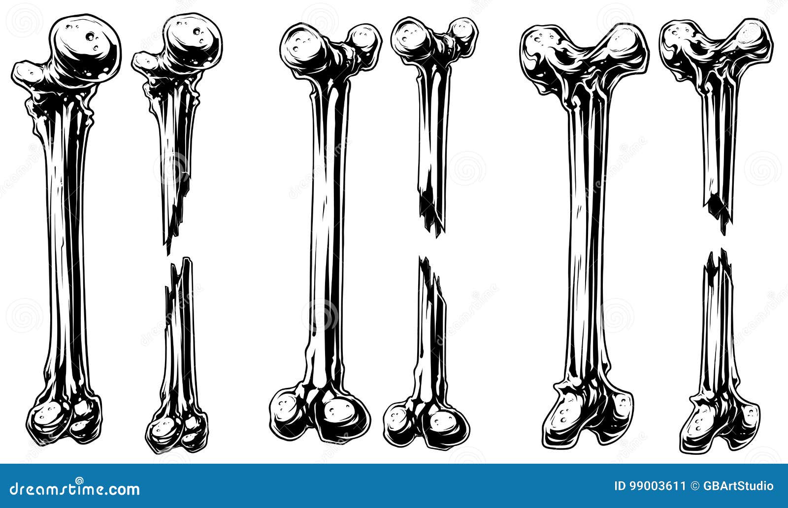 Graphic Black and White Broken Bones Vector Set Stock Vector ...