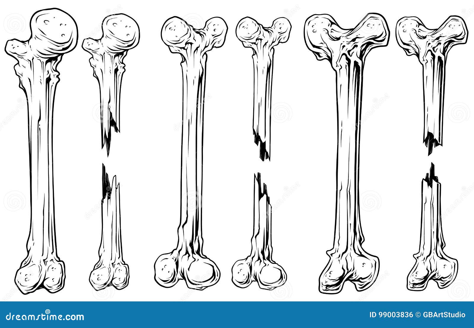 Graphic Black And White Broken Bones Vector Set Stock Vector Illustration Of Logo Anatomy