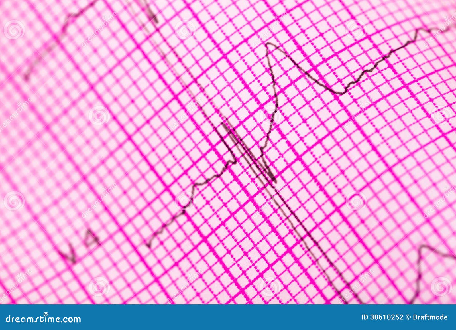 Graphique de cardiogramme photo stock. Image du sang - 30610252