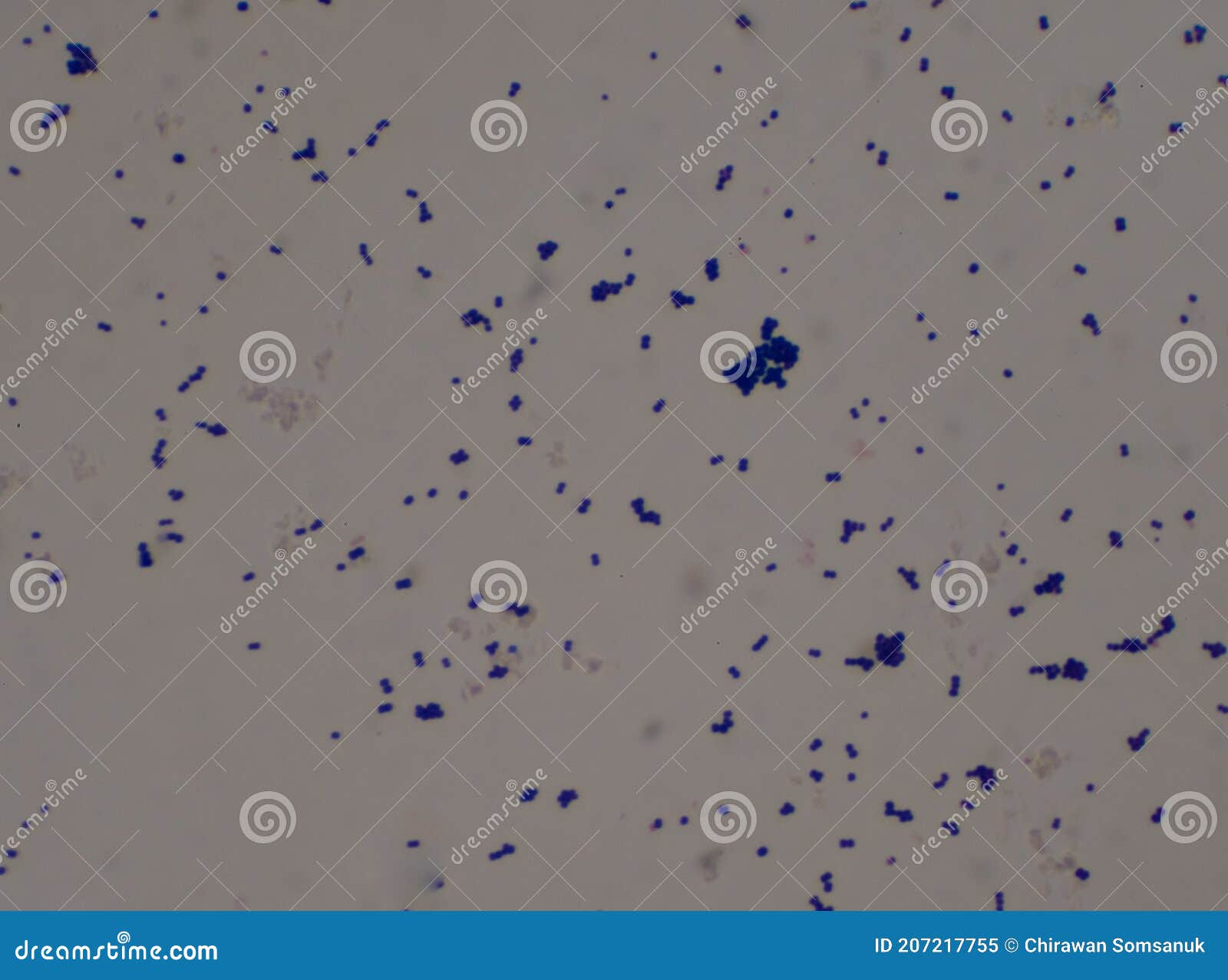 Grasa gramo coco positivo imagen de archivo. Imagen de epidemia - 207217755