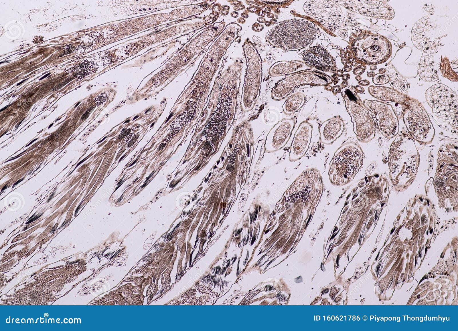 Grasshopper Testis Dissection