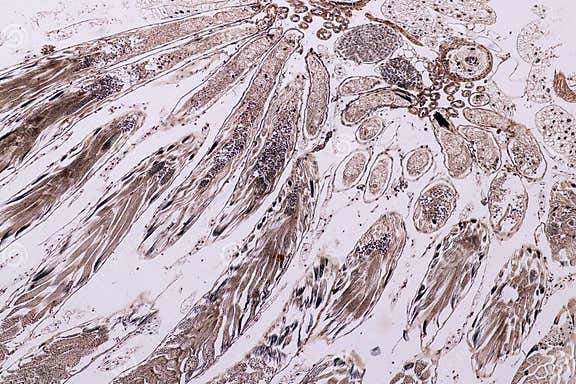 Grasshopper Testis Under the Microscope in Lab. Stock Photo - Image of ...