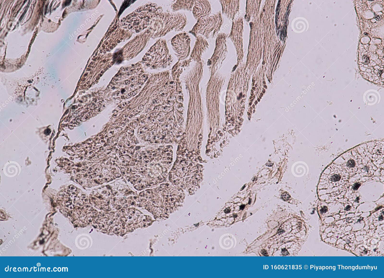 Grasshopper Testis Dissection