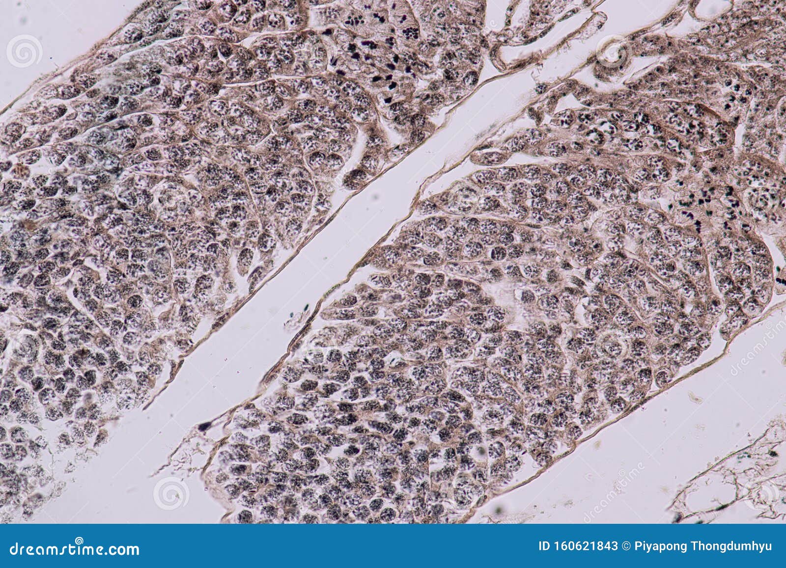 Grasshopper Testis Under the Microscope in Lab. Stock Image - Image of ...