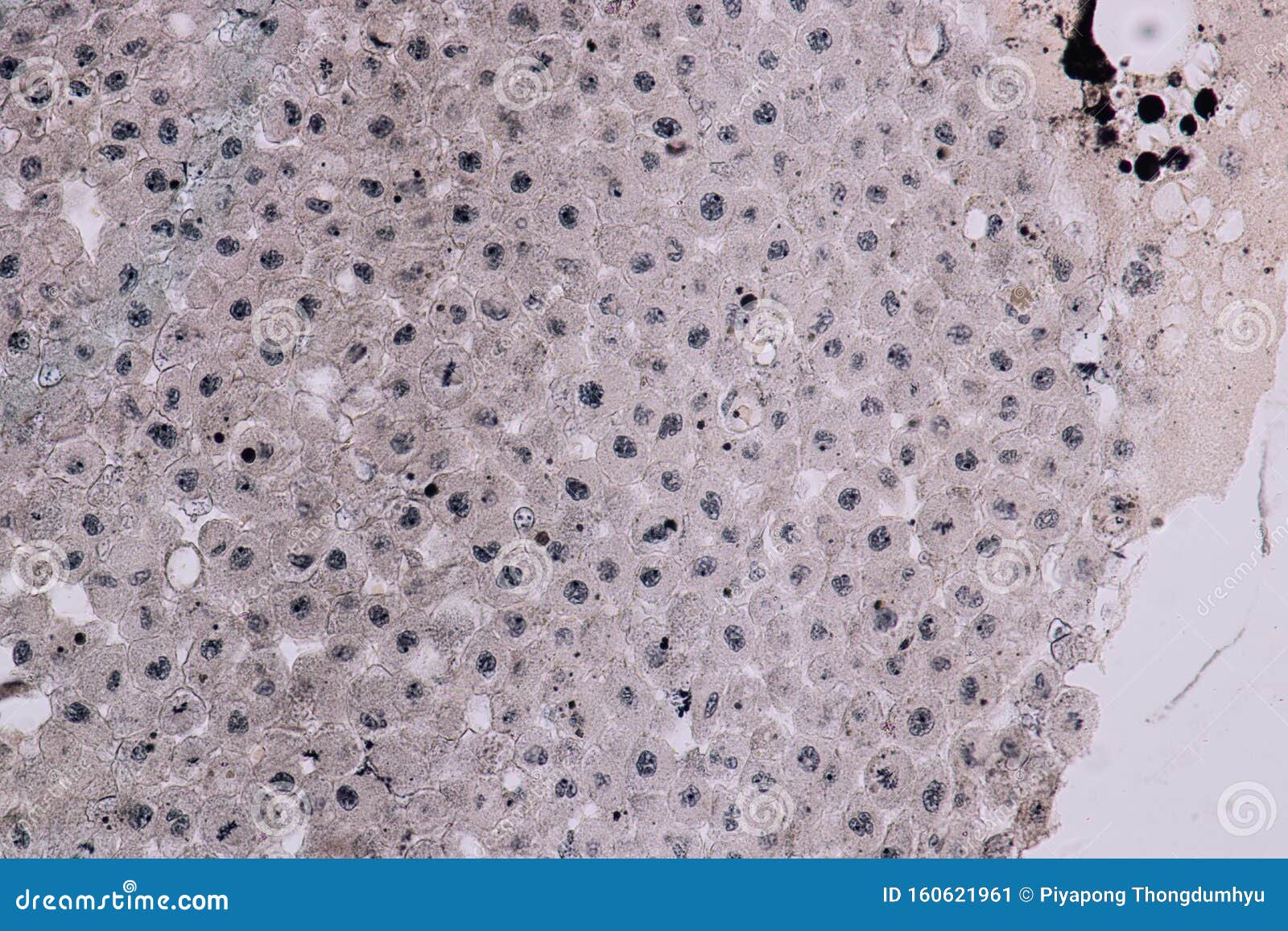 Grasshopper Testis Under the Microscope in Lab. Stock Image - Image of ...