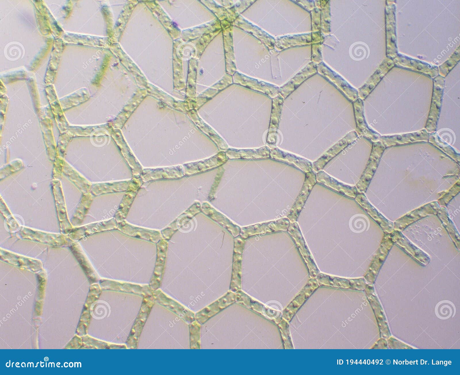 Green Algae at High Magnification Stock Photo - Image of organisms ...