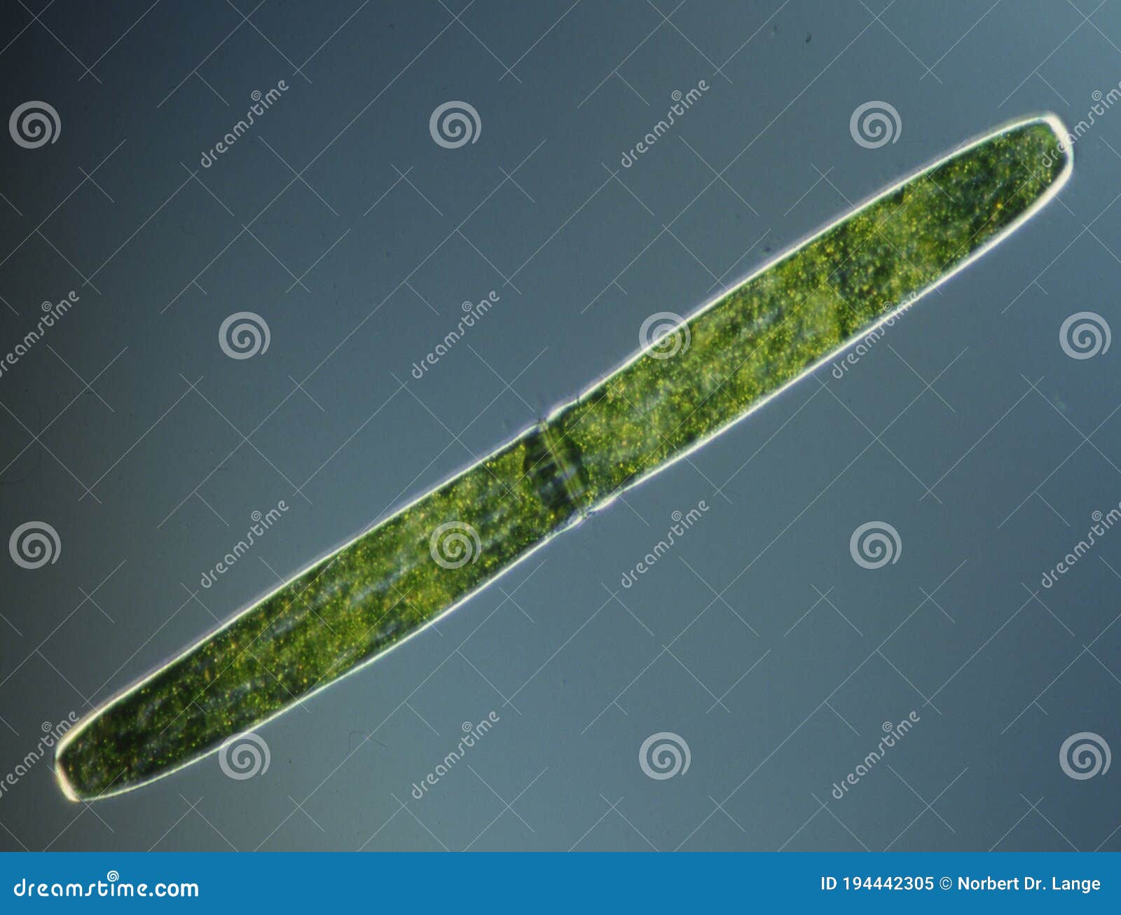 Green Algae at High Magnification Stock Image - Image of macro ...