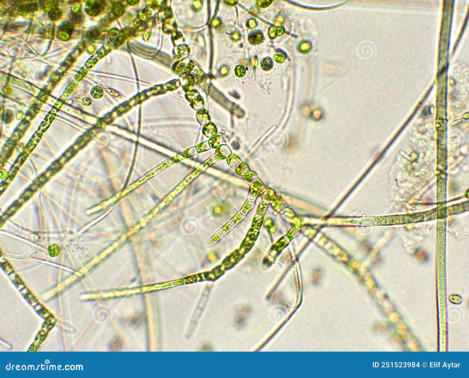 Green Algae Under Microscopic View, Chlorophyta Stock Photo - Image of ...