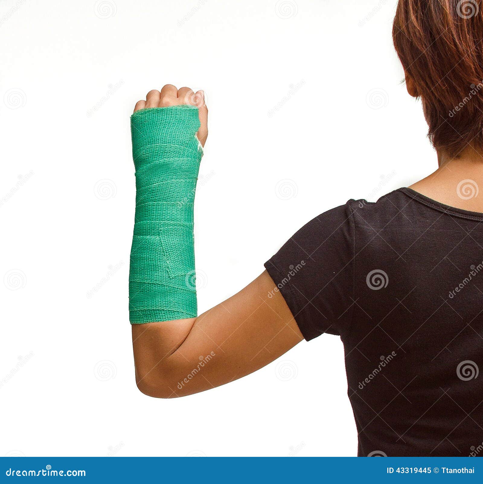 Green Arm Cast