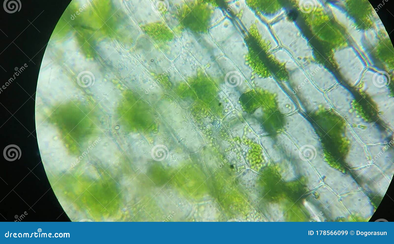 Eukaryotic Plant Cells Under Microscope