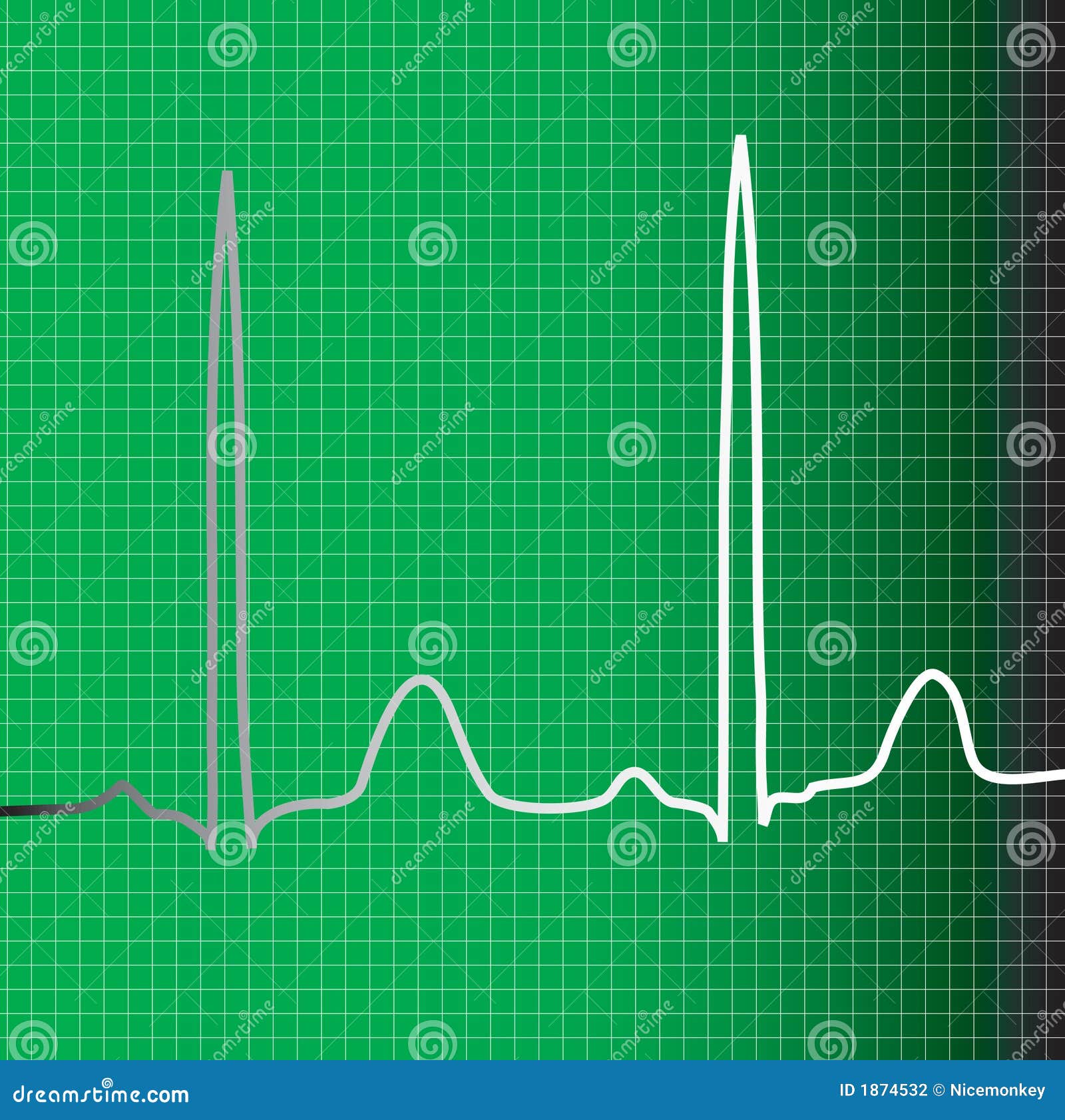 Green ecg stock vector. Illustration of medical, electrocardiogram ...