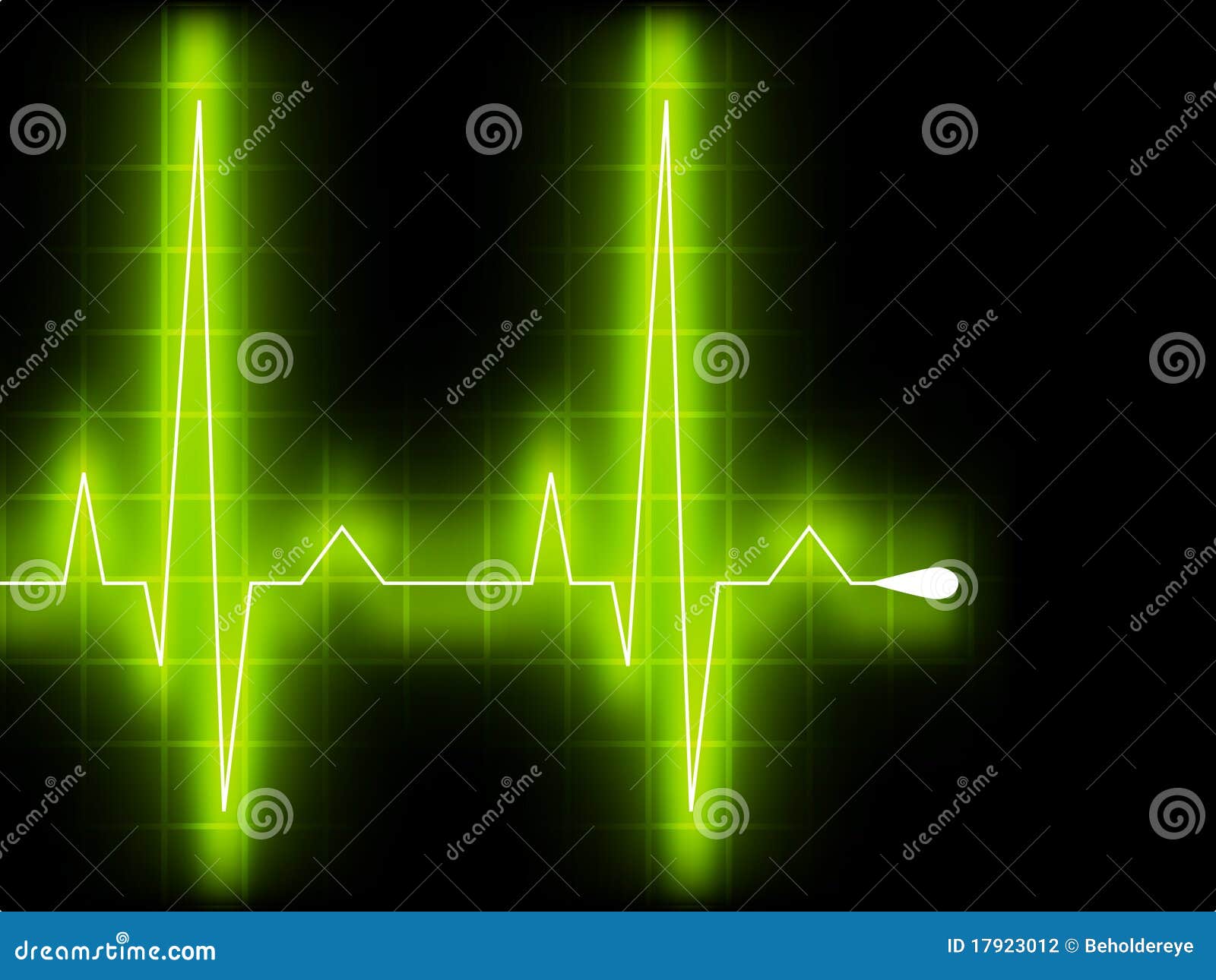 Green Heart Beat. Ekg Graph Stock Vector - Illustration of care, health ...
