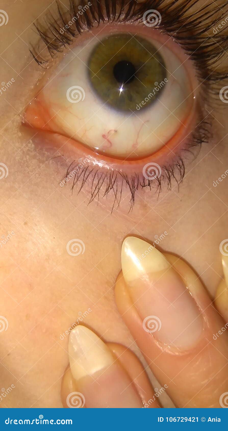 Red eye stock image. Image of nails, green - 106729421