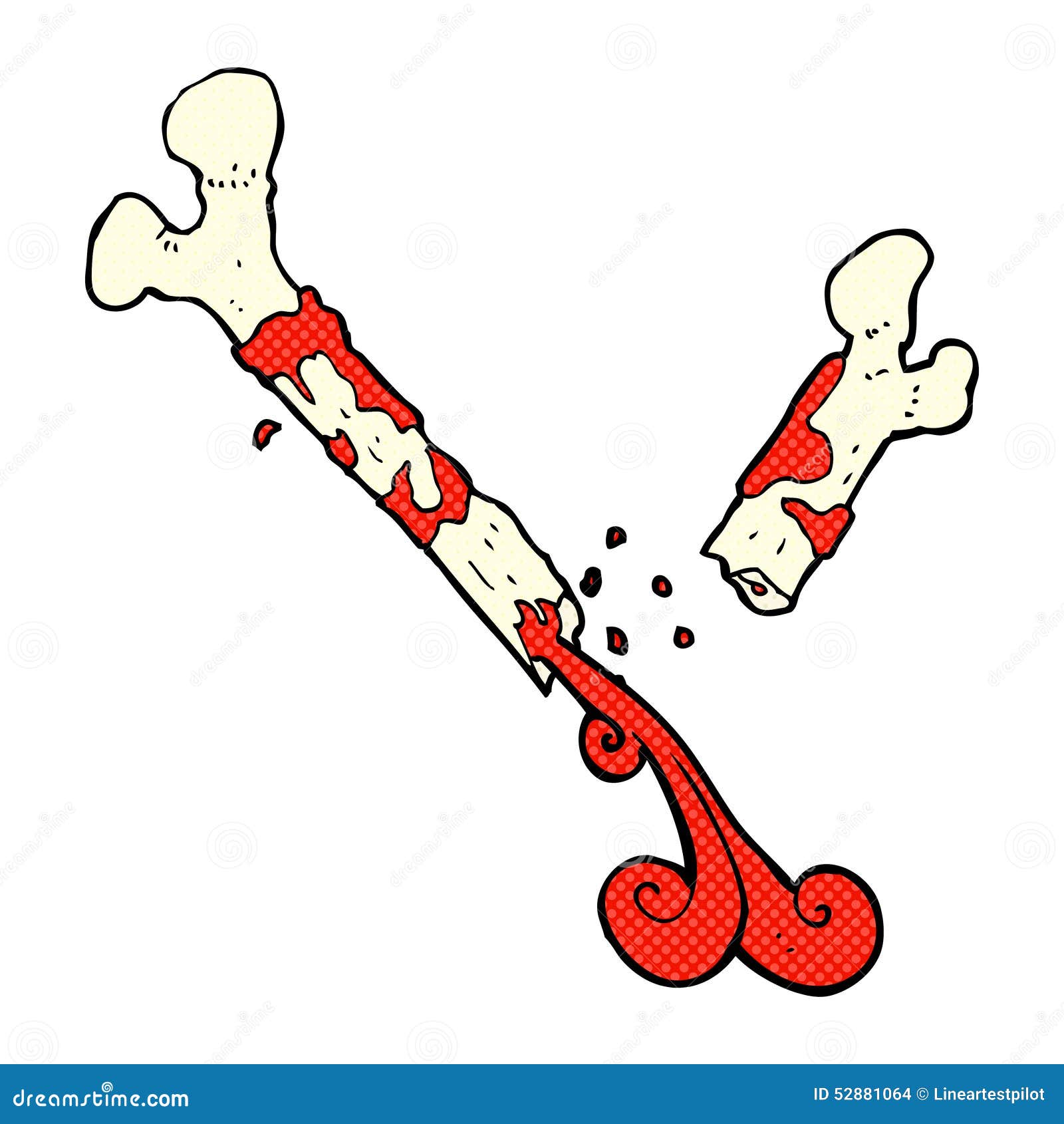 Gross Broken Bone Comic Cartoon Stock Photography | CartoonDealer.com ...