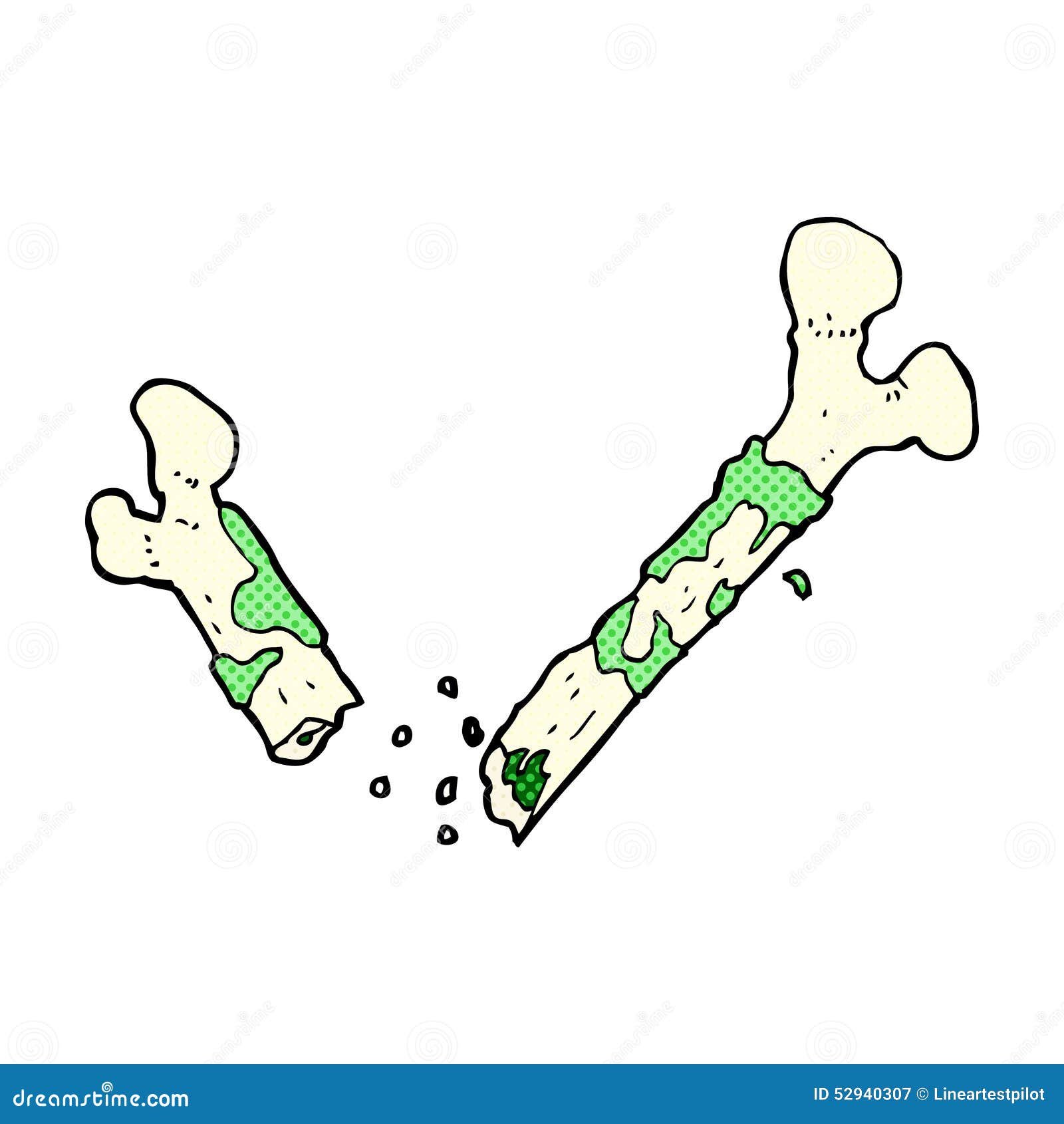 Gross Broken Bone Comic Cartoon Stock Photography | CartoonDealer.com ...