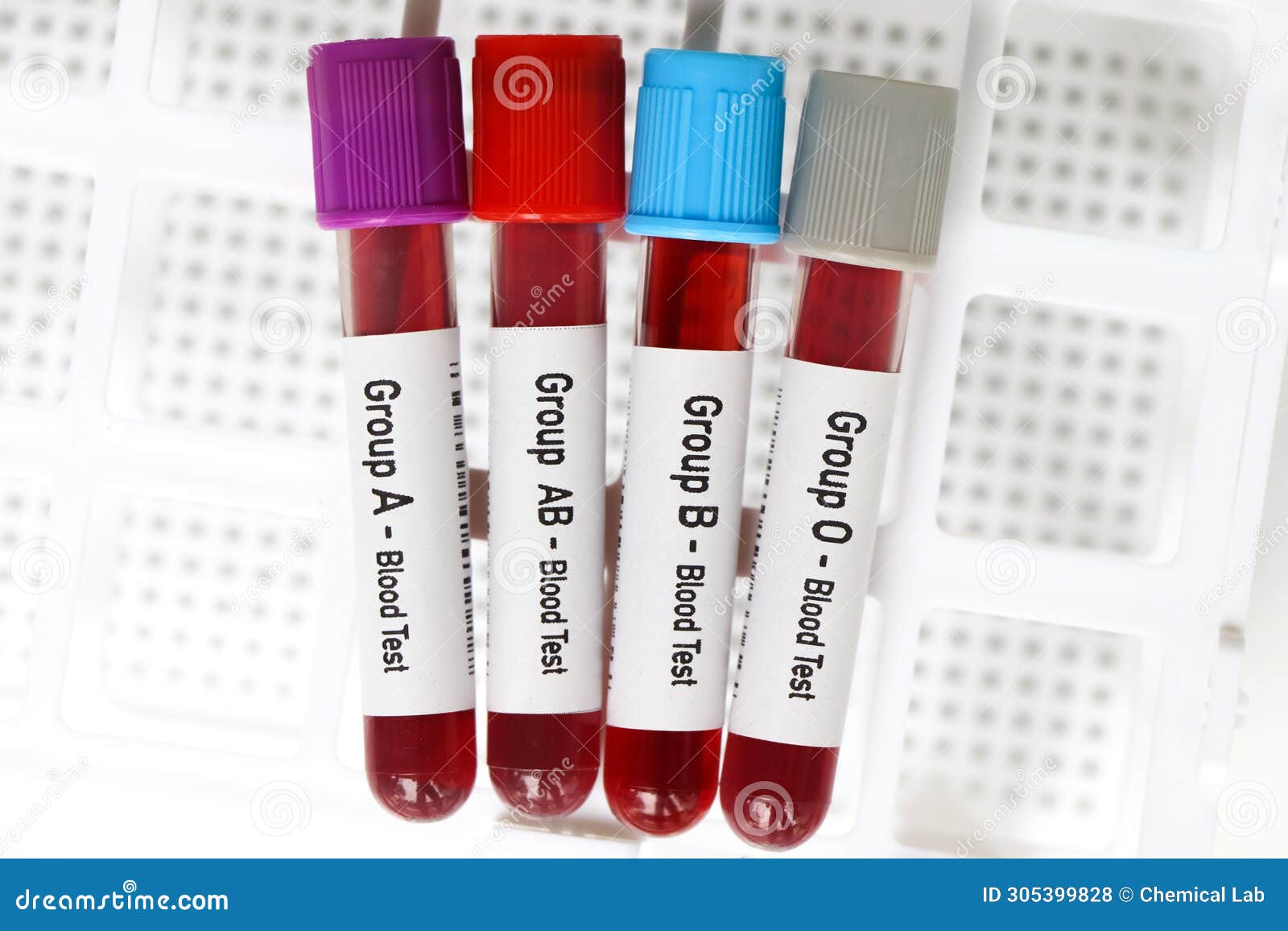 Group Blood Test, Blood Sample To Analyze in the Laboratory Stock Photo ...