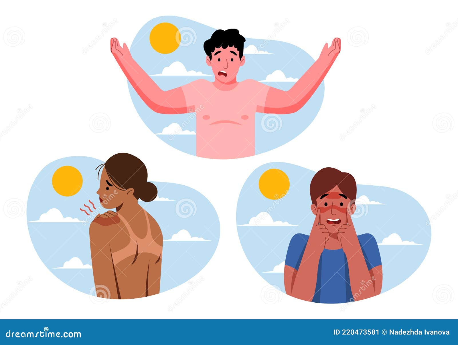 Group Of Different People With A Sunburn Vector Illustration Stock