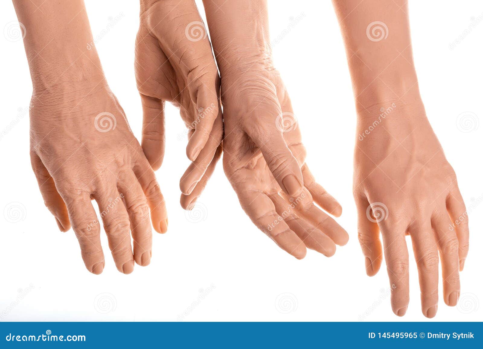 Group Silicone Prosthesis Hands, Medicine Pink Implants Stock Image ...