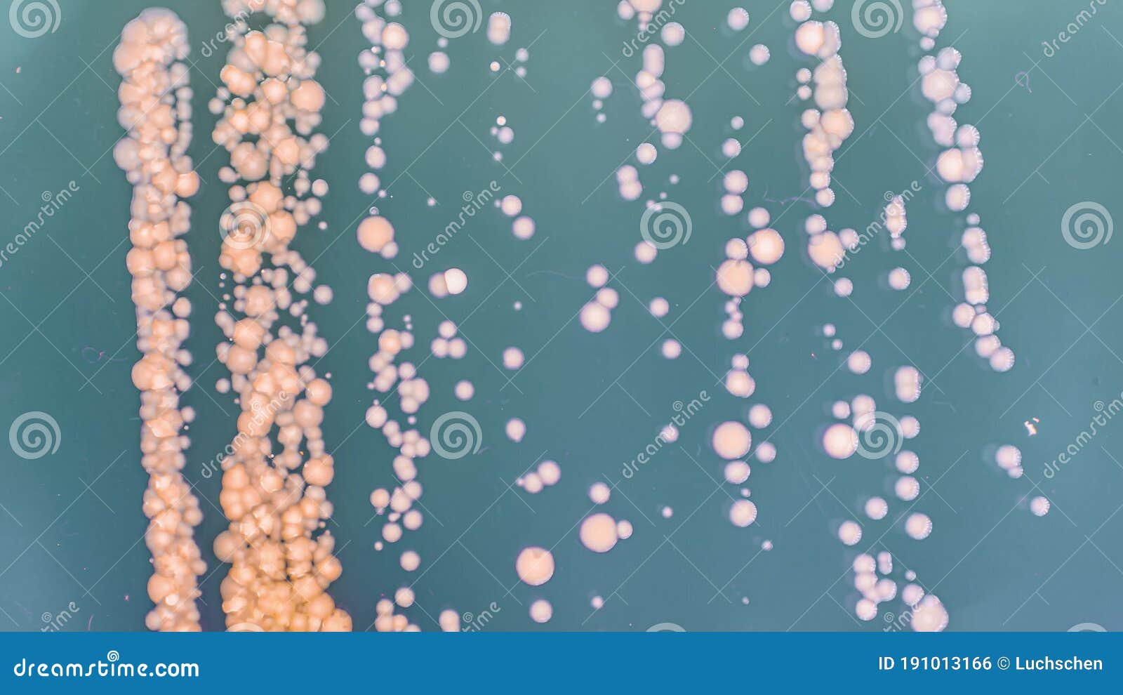 Growth of Colonies of Pathogenic Bacteria in Laboratory Analysis of ...