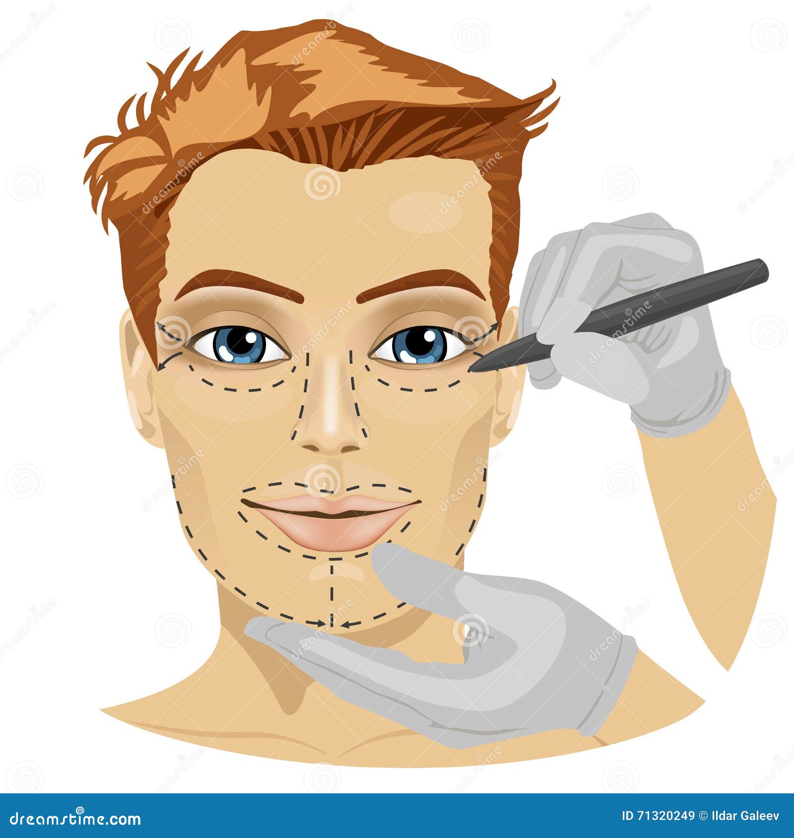 Guide Lines for Surgical Incisions on a Patient Male Face Stock Vector ...