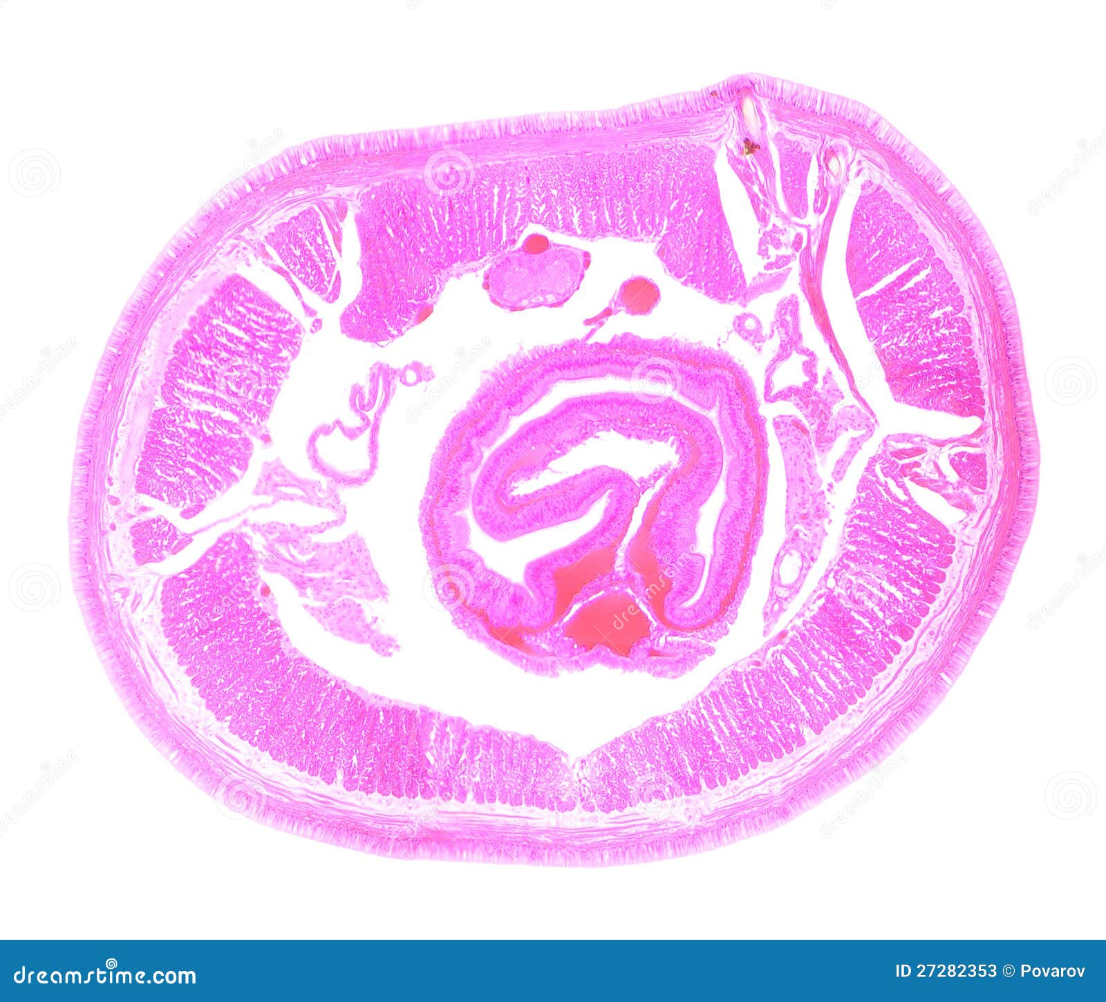 Gusano Bajo Microscopio Real