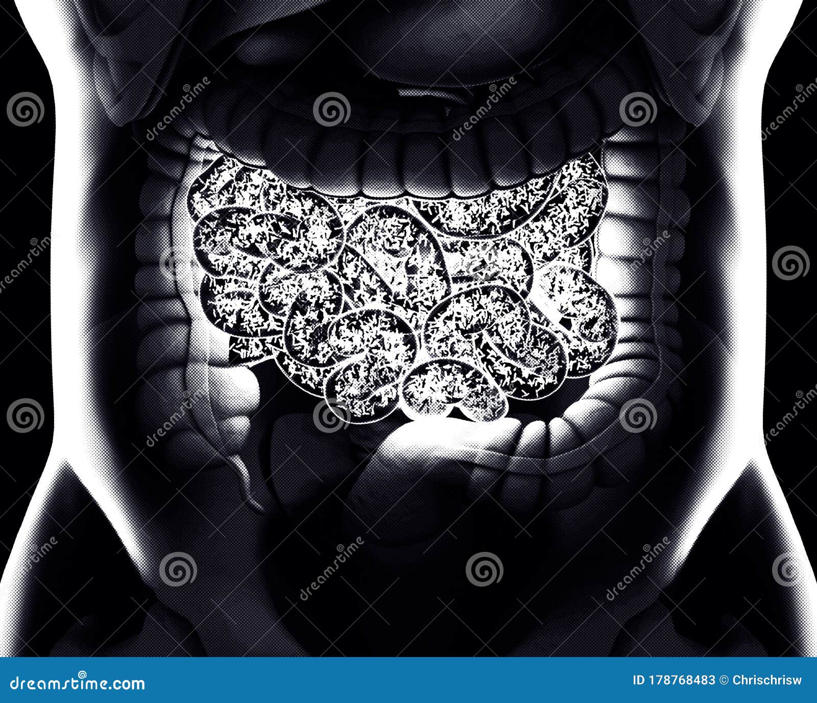 Gut Bacteria , Gut Flora, Microbiome. Bacteria Inside the Small ...