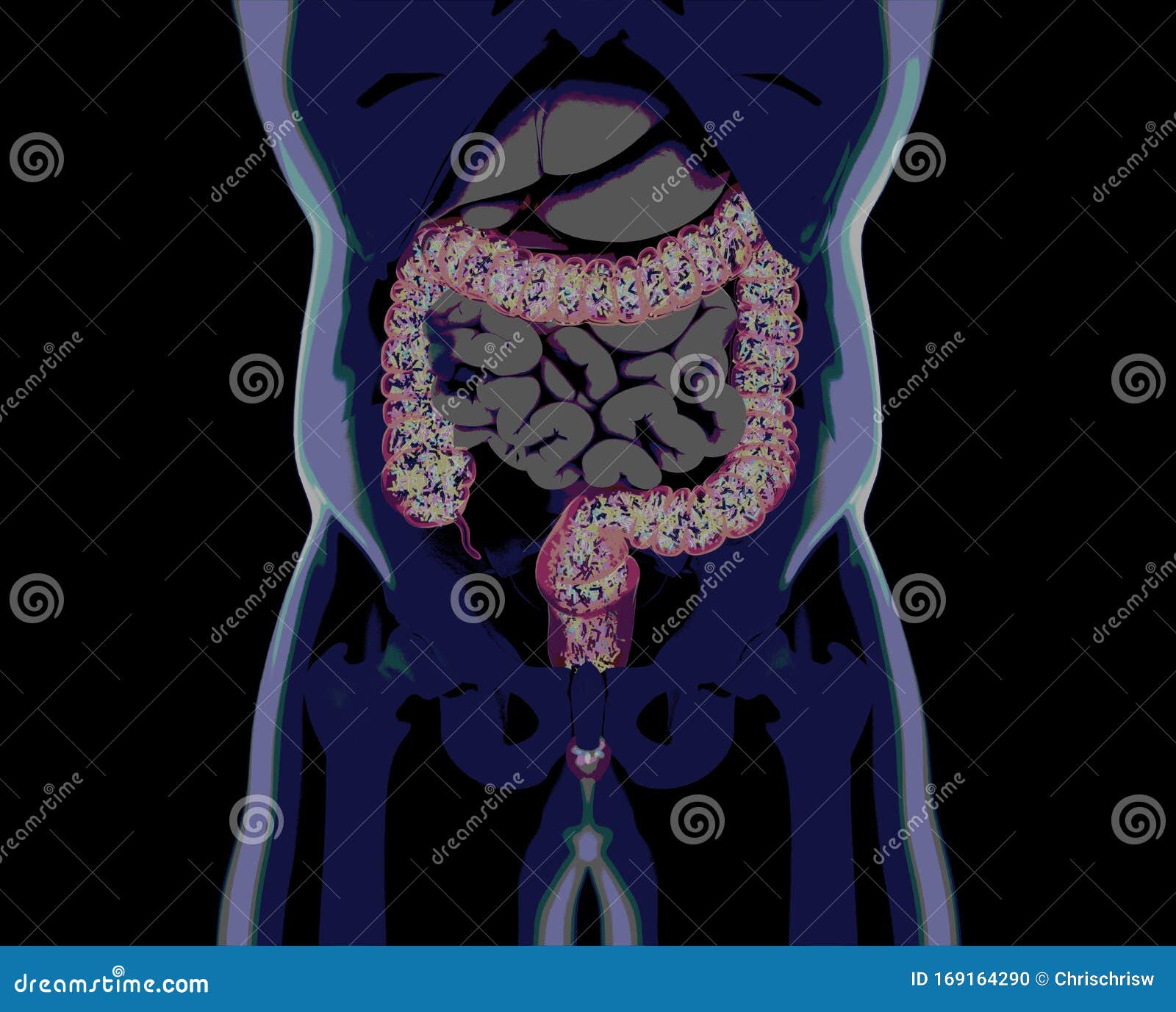 Gut Bacteria, Microbiome. Bacteria Inside the Large Intestine, Concept ...