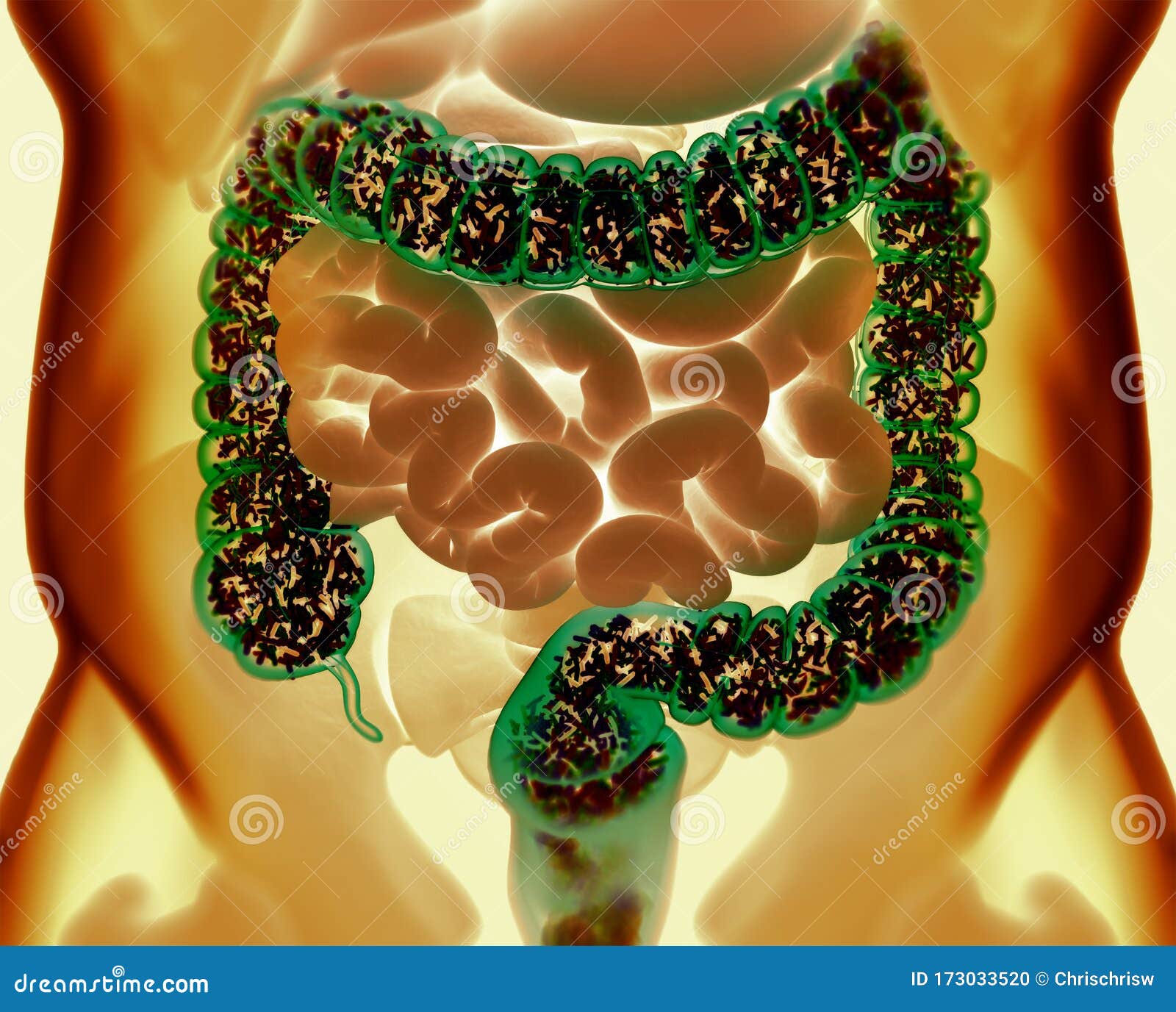 Gut Bacteria, Microbiome. Bacteria Inside The Large Intestine, Concept ...