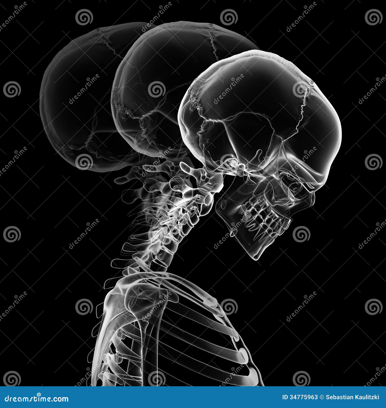 Guy Bending His Neck Royalty-Free Cartoon | CartoonDealer.com #34776119