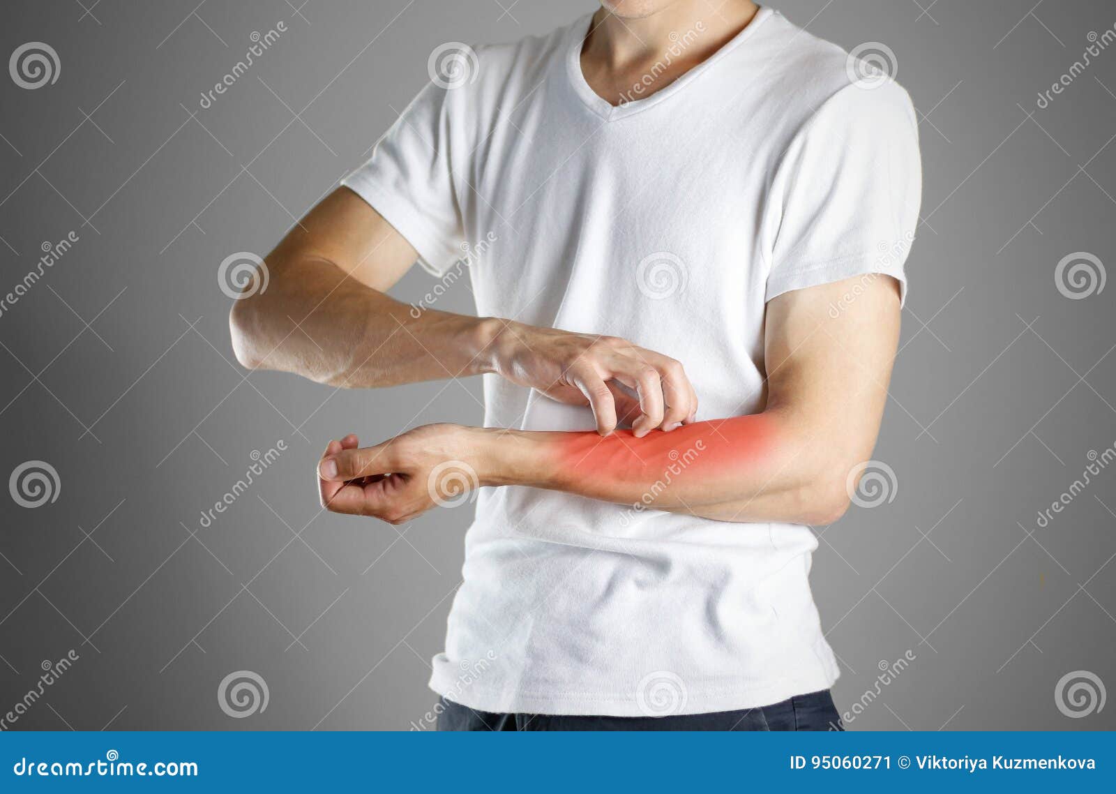 Guy in White Shirt Scratching His Arm. Scabies Stock Image - Image of ...