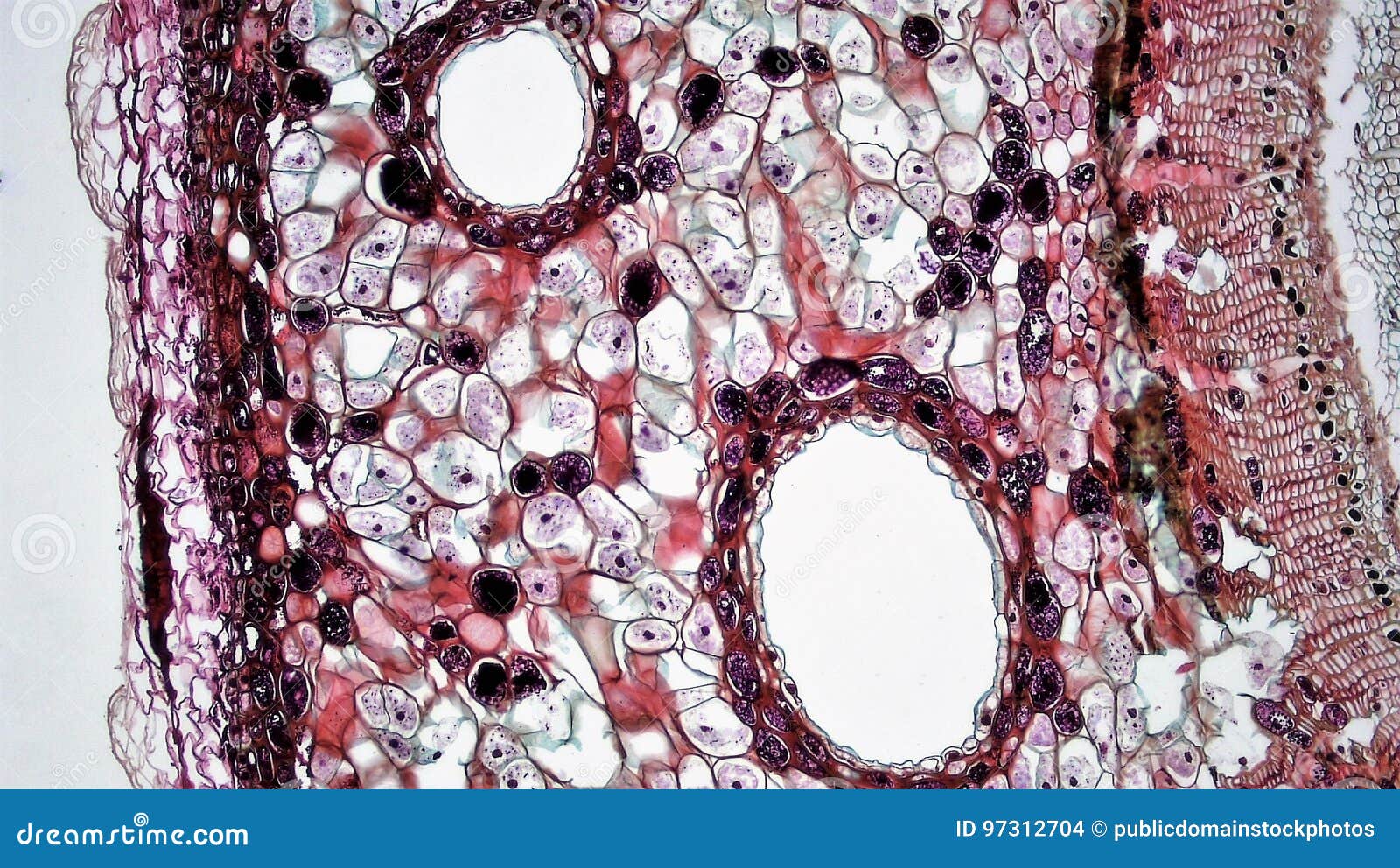 Gymnosperm Stem: Cork And Cortex In Three Year Pinus Picture. Image ...