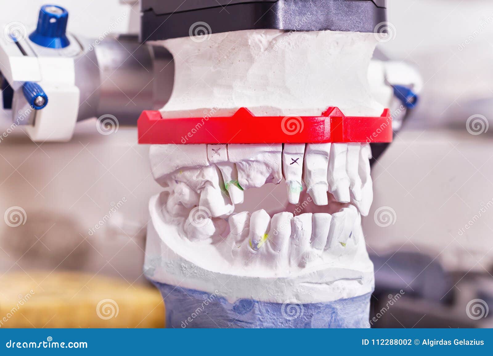 Gypsum Dental Model in a Dental Clinic Stock Photo - Image of colour ...