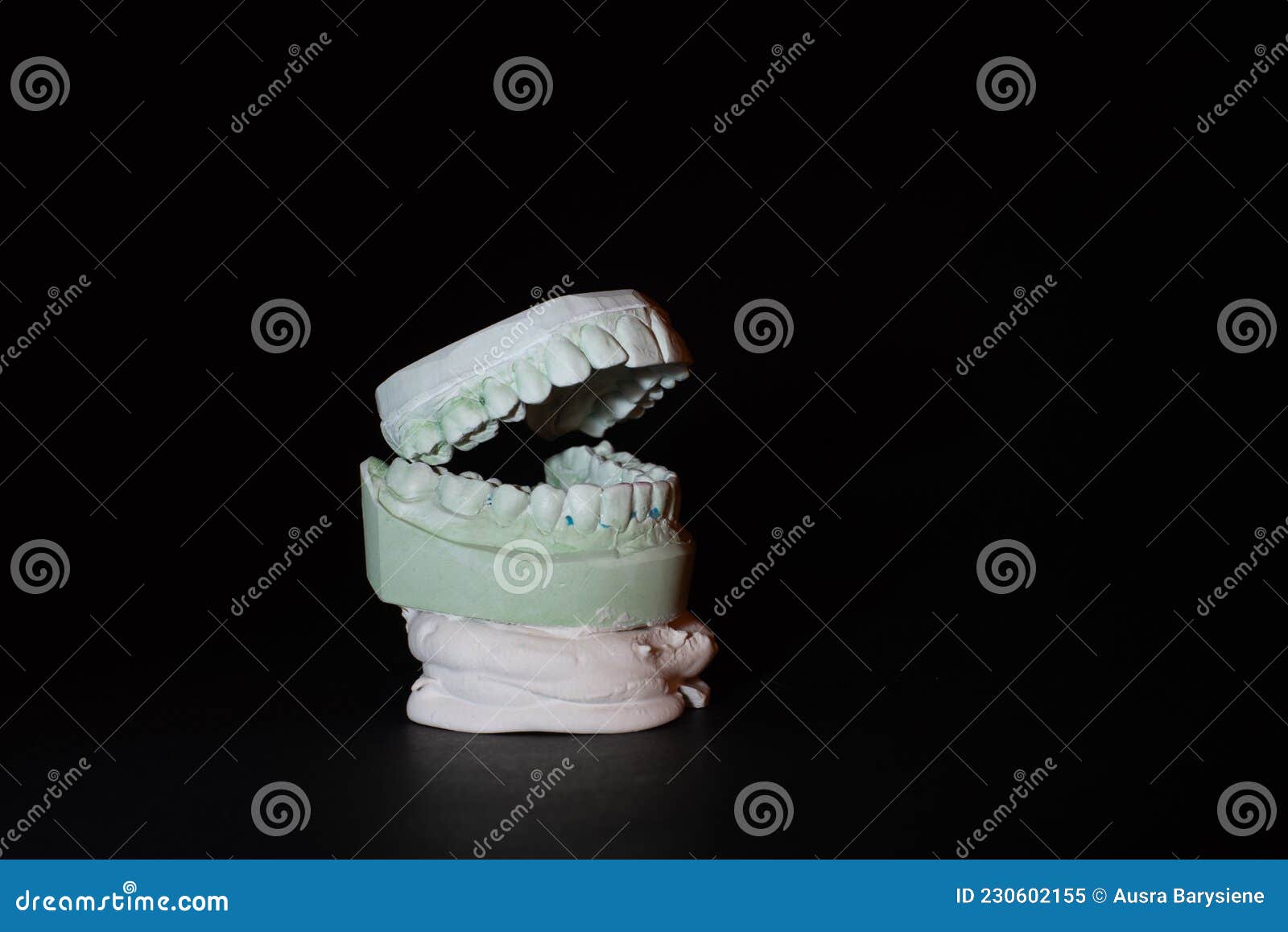 Gypsum Dental Model of Human Teeth on Black Background. Stock Image ...