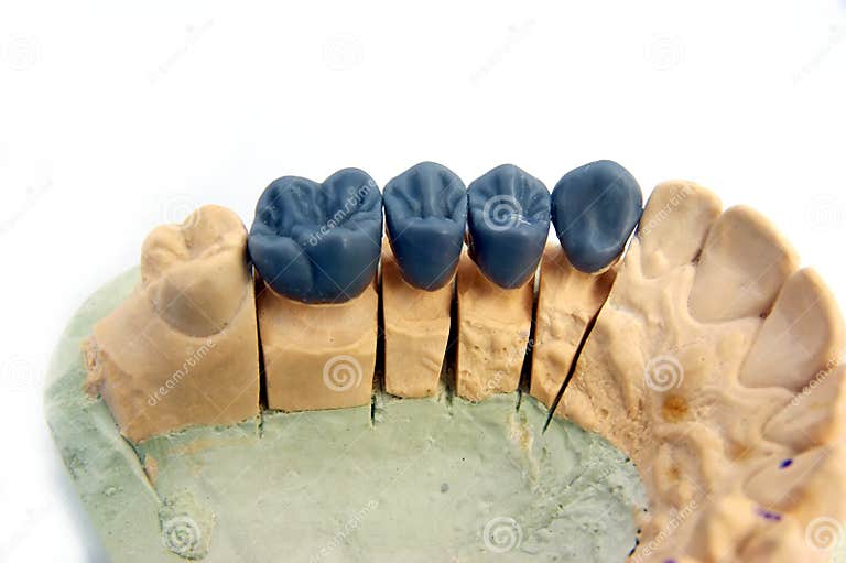 Gypsum model stock image. Image of articulator, body, level - 7148841