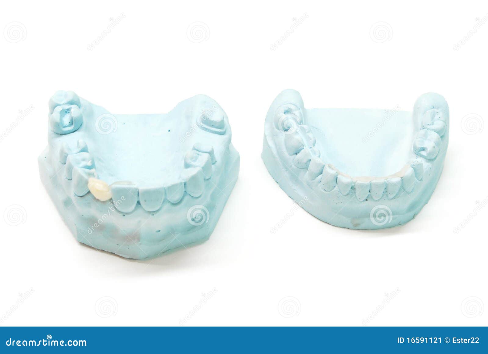 Gypsum Model of Human Teeth Stock Image - Image of orthodontic, oral ...