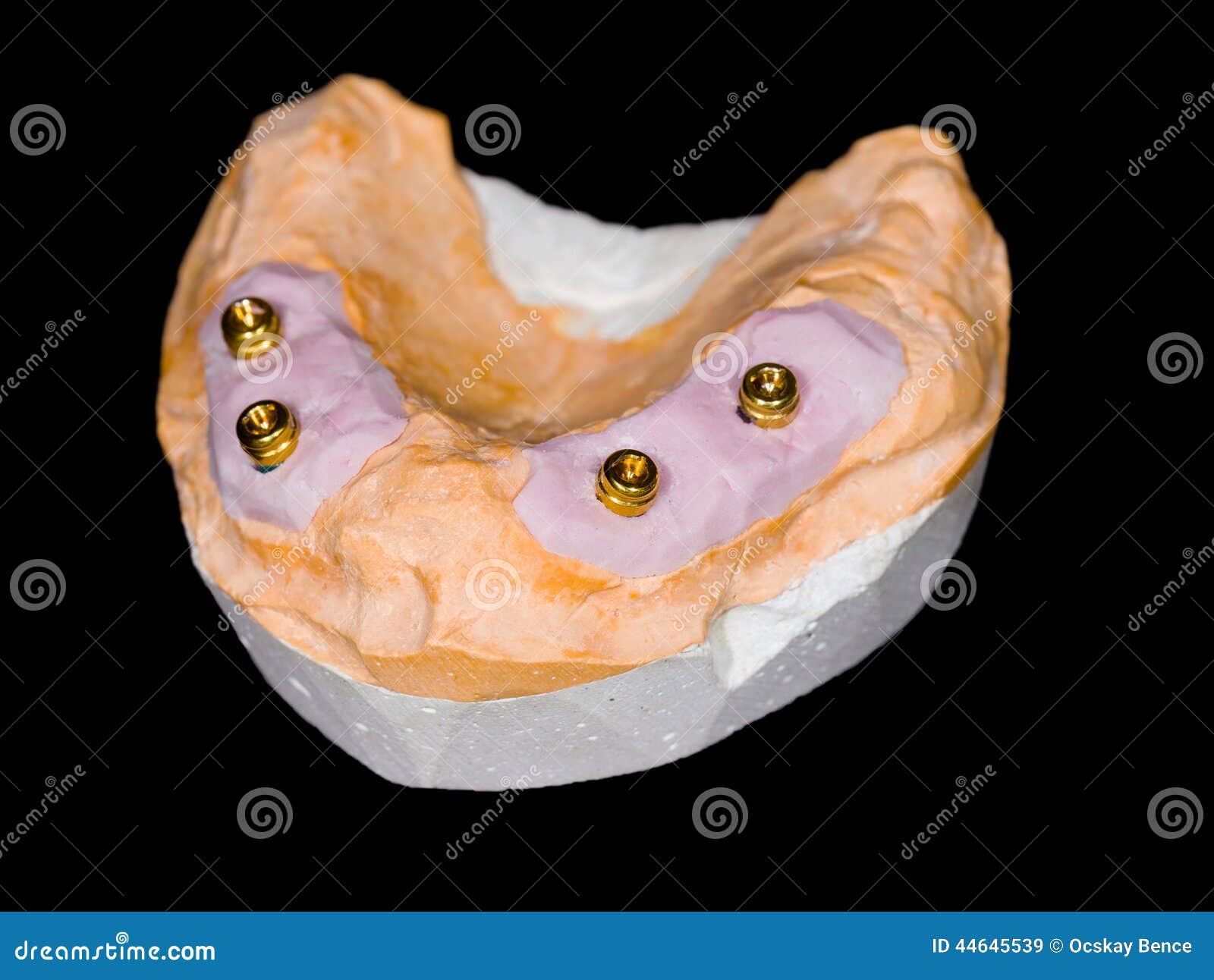Gypsum model with implants stock image. Image of aesthetic - 44645539