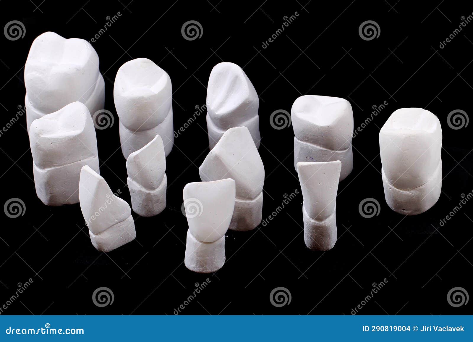 Gypsum teeth model stock photo. Image of dentist, black - 290819004