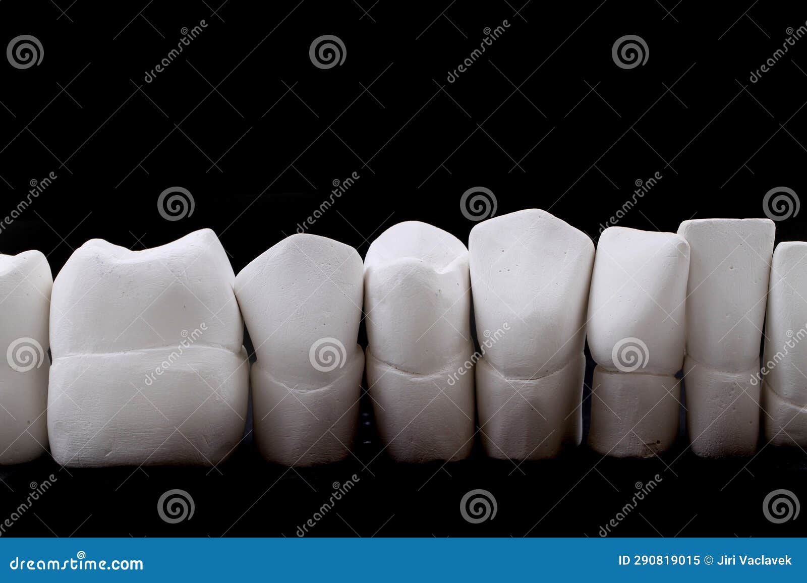 Gypsum teeth model stock image. Image of healthy, mould - 290819015