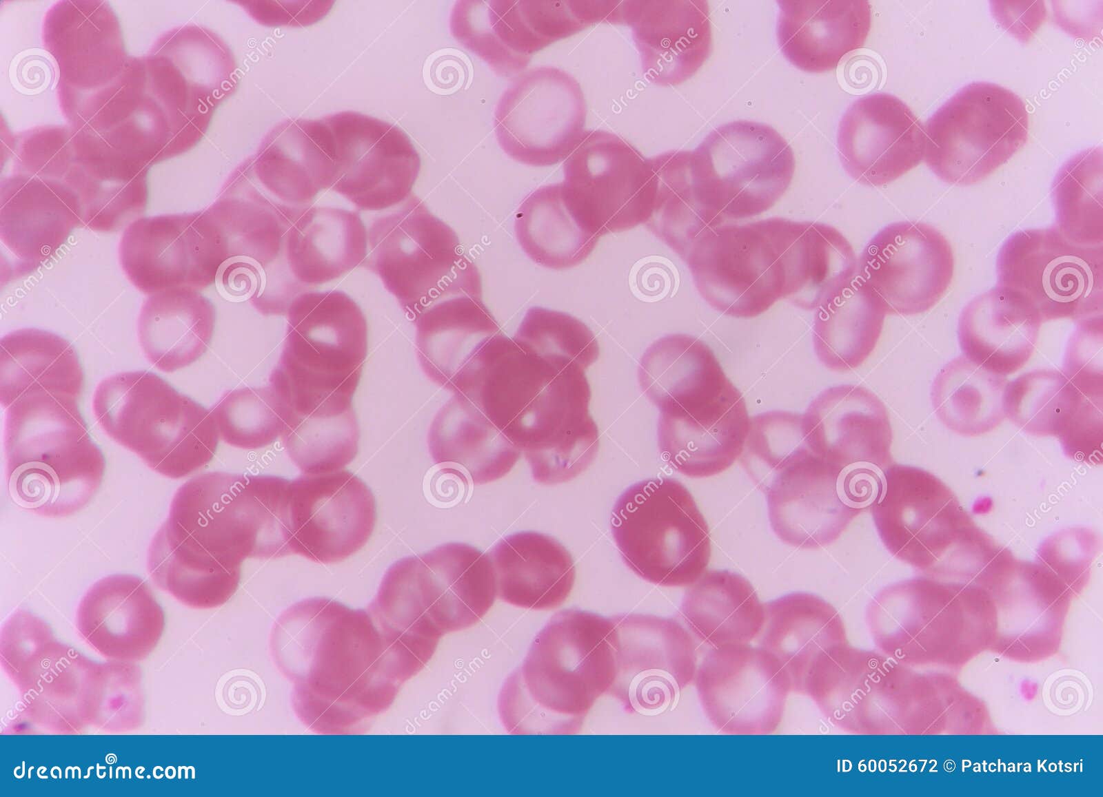 Hémogramme photo stock. Image of microscope, santé, sang - 60052672