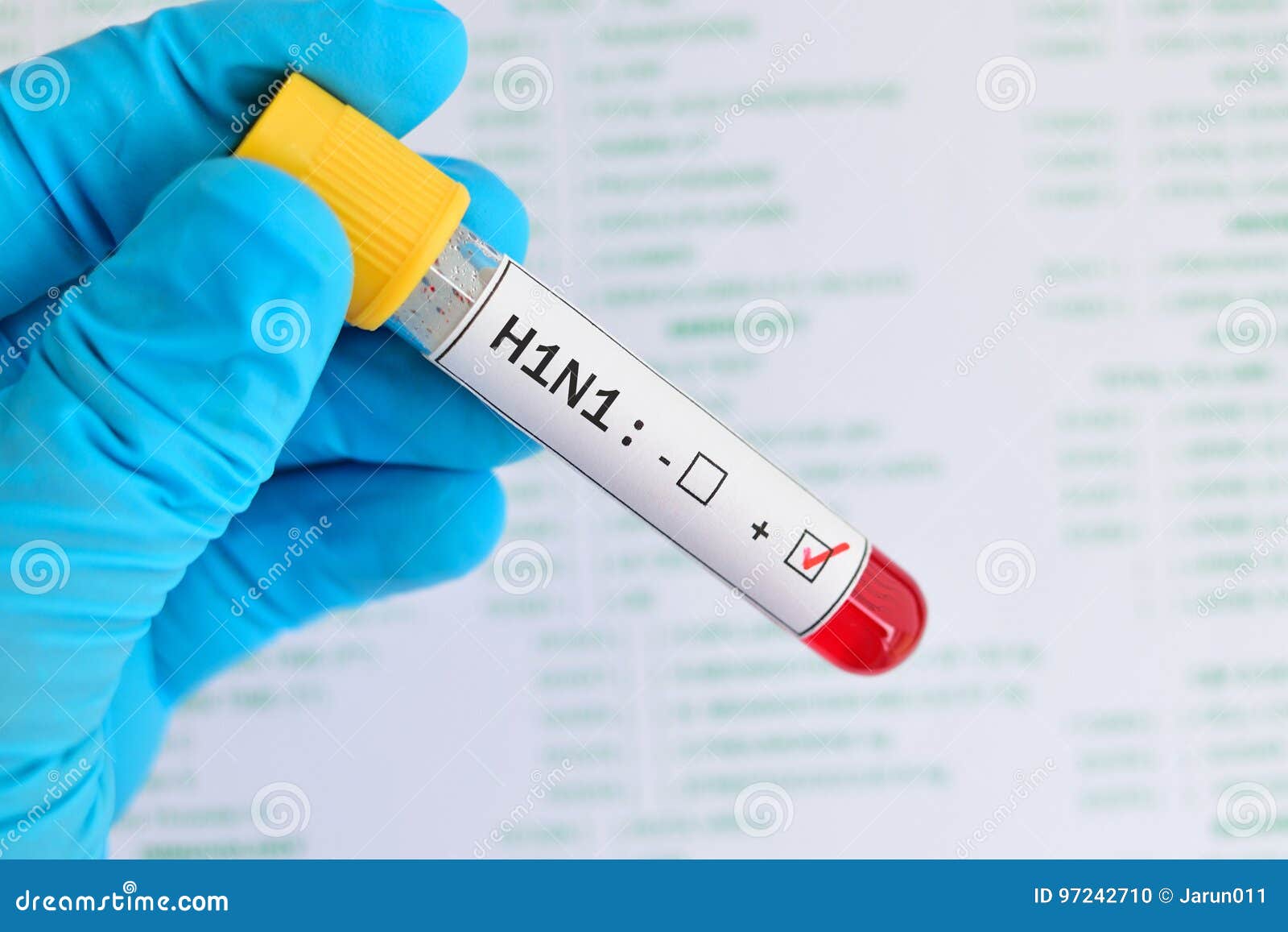 H1N1 positive stock photo. Image of h1n1, virus, scientific - 97242710