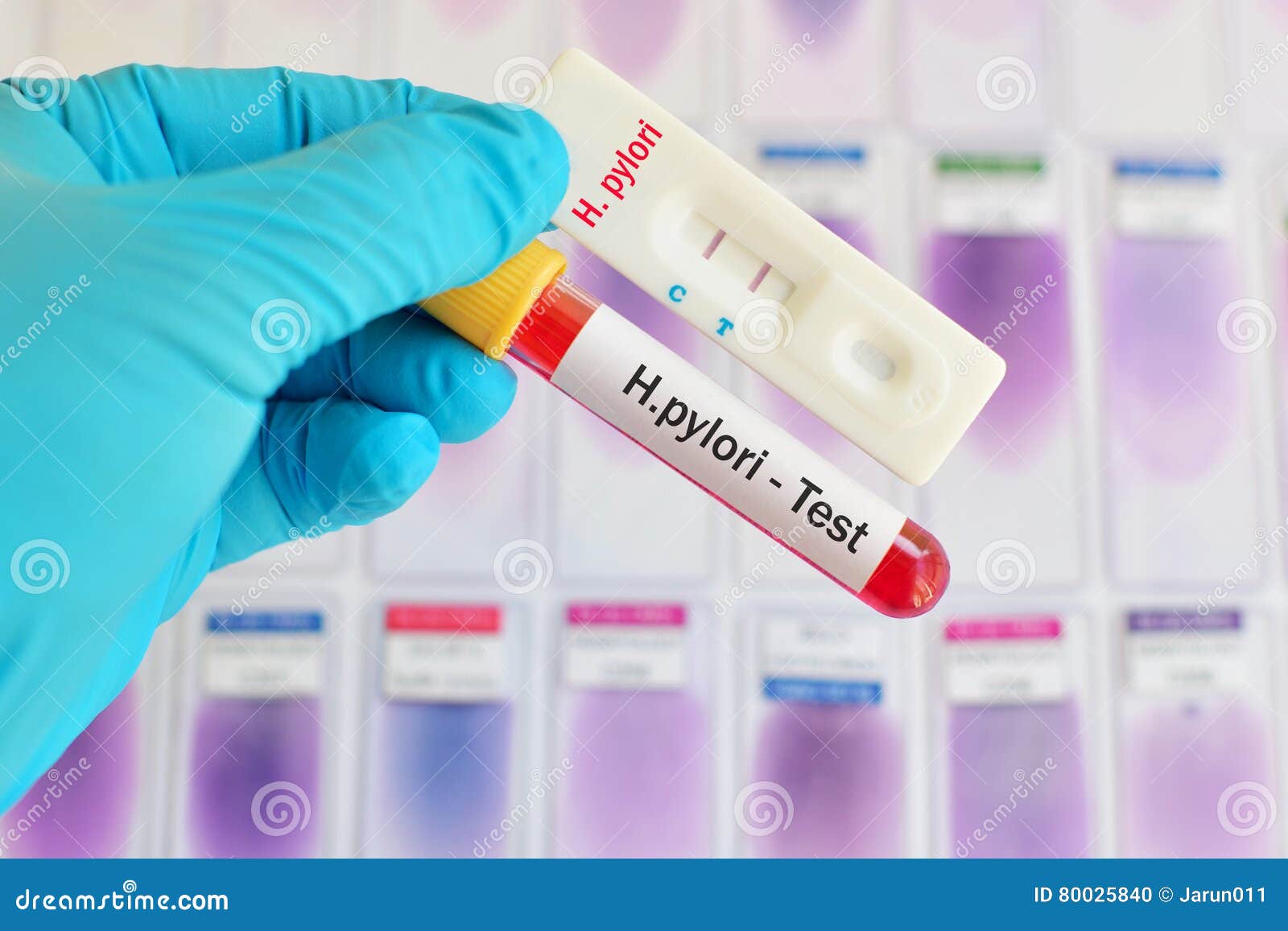 H. pylori positive stock photo. Image of infection, helicobacter - 80025840