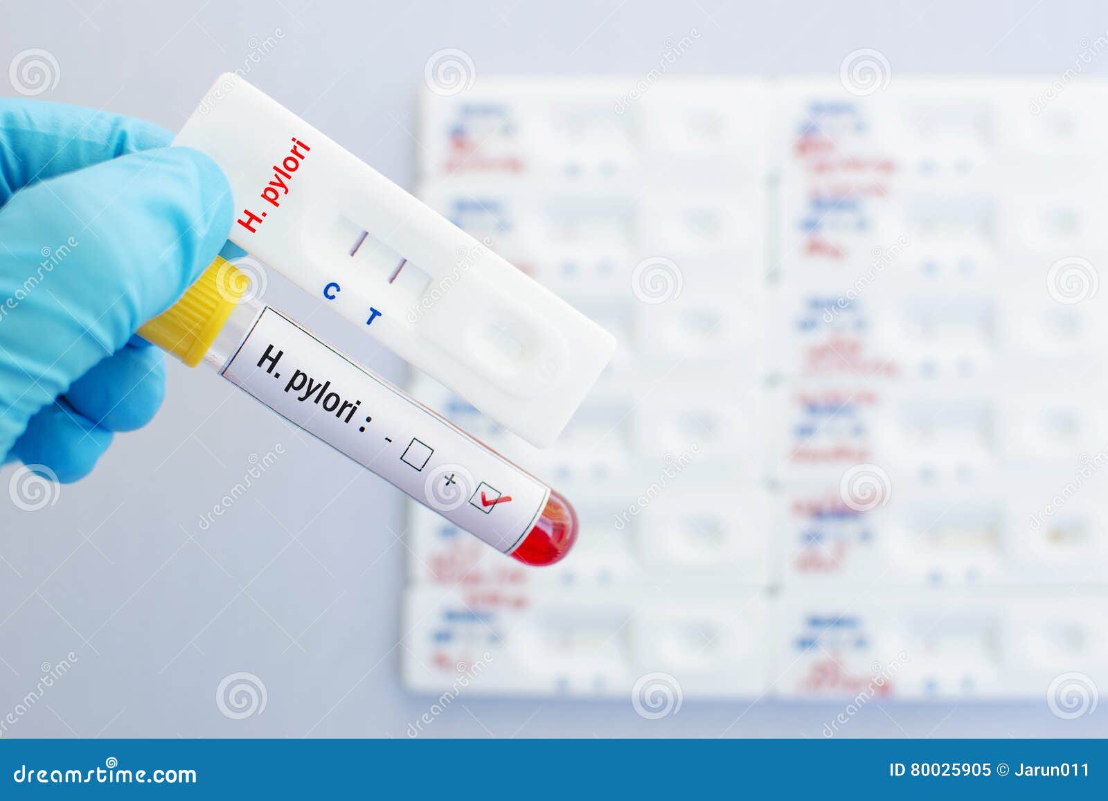 H. pylori positive stock image. Image of biology, diagnosis - 80025905