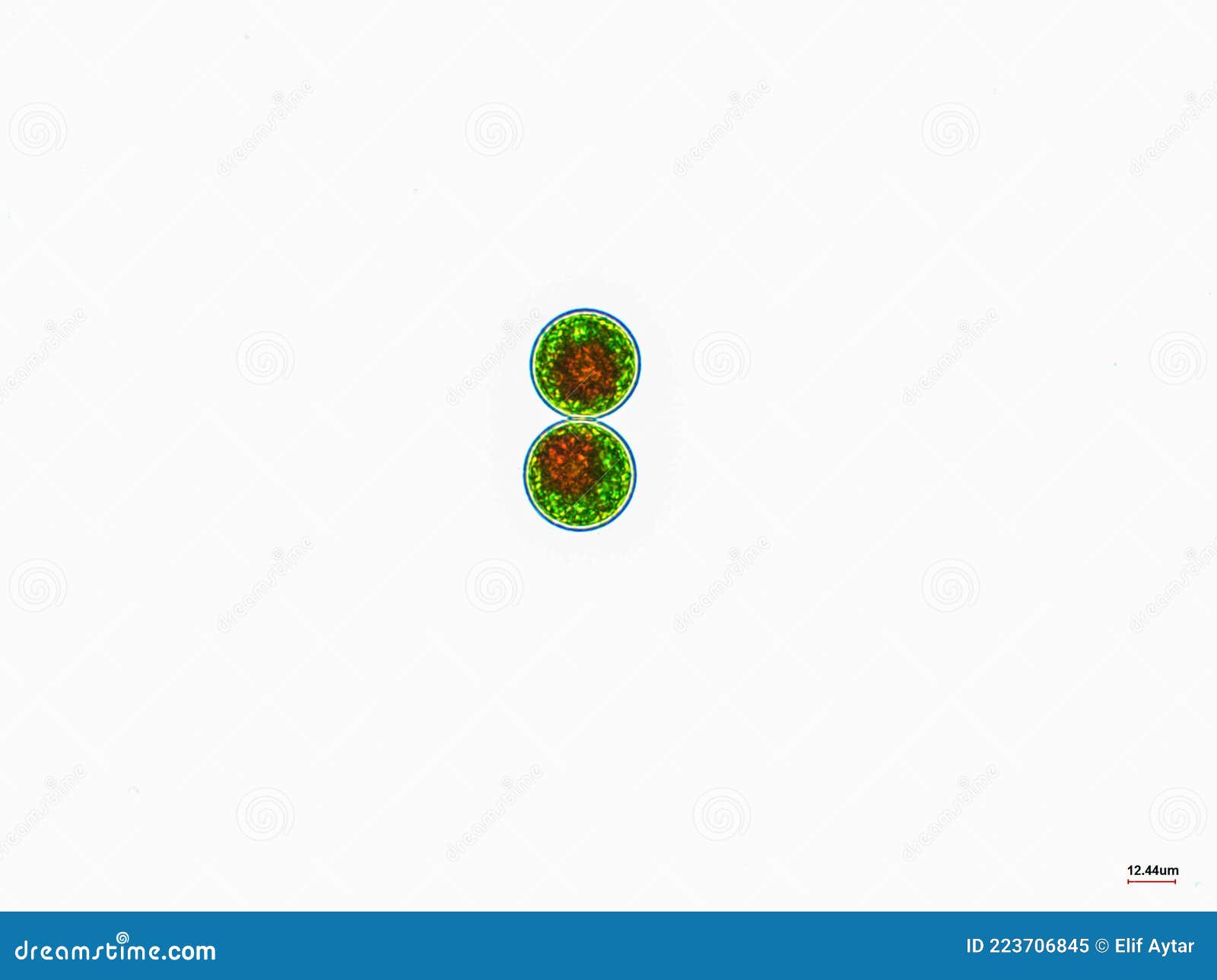 Haematococcus Pluvialis Algae Under Microscopic View Stock Image ...
