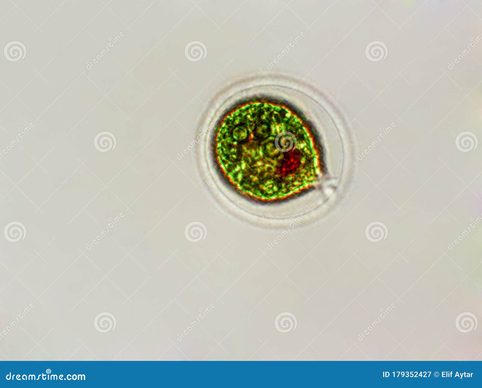 Haematococcus Pluvialis Algae Under Microscopic View - Vegetative Cell ...