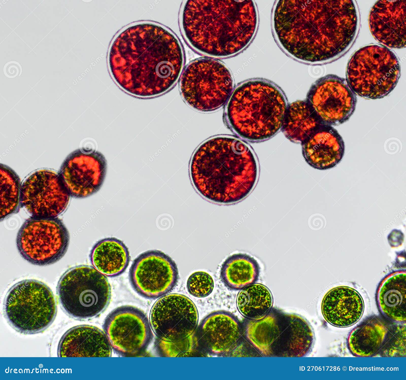 Haematococcus Pluvialis Cyst Algae Under Microscopic View - Haematocyst ...